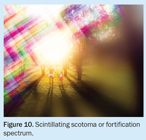 Flashes and floaters: symptoms not to be ignored | Medicine Today